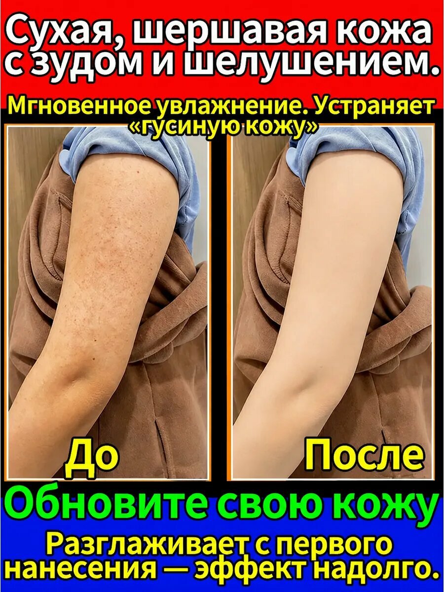 Крем для тела против гиперкератоза
