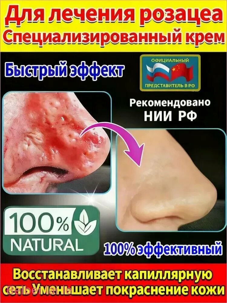 Сыворотка для лица от прыщей, крем для лица aravia питательный, крем для лица от розацеа, мазь от купероза на лице, ритема, натуральная, негормональная, быстродействующая,20g