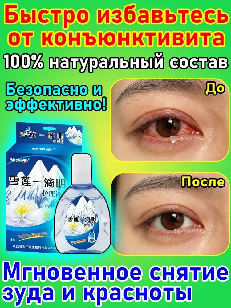 Капли от конъюнктивита для человека