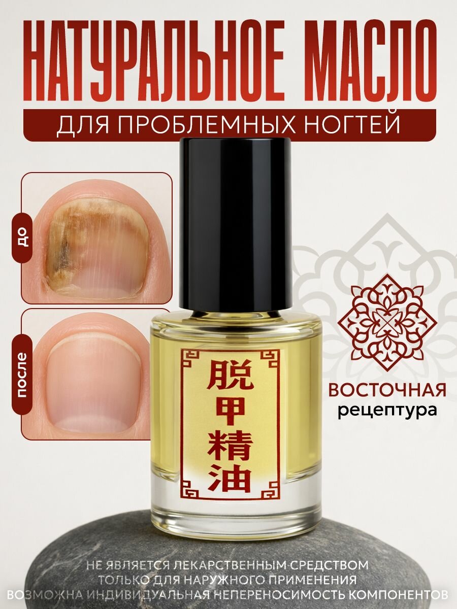 Эффективное средство от грибка ногтей на ногах и руках, масло, Стоп онихолизис, 5 мл, Средства для маникюра или педикюра: масло косметическое для ногтей и кутикулы