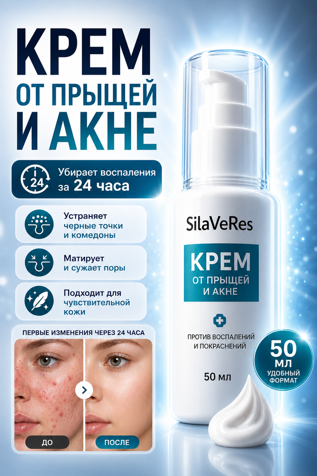 Крем от прыщей, акне и постакне SilaVeres, 50 мл, для лица и тела с цинком и серой