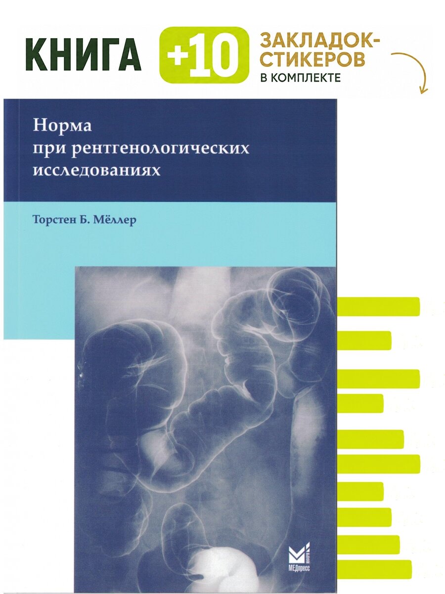 Норма при рентгенологических исследованиях. Комплект: книга + 10 закладок-стикеров