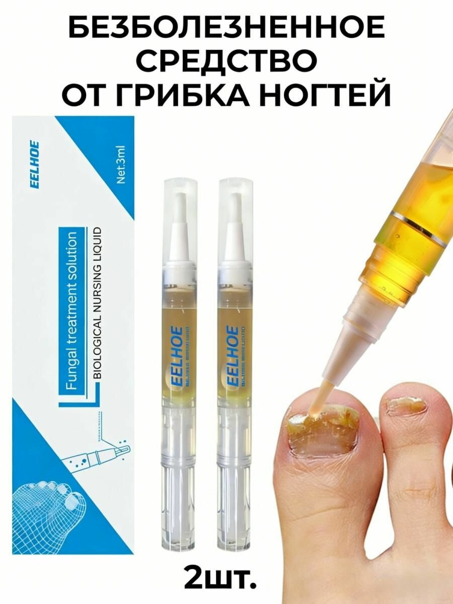 2шт Противогрибковый лак для ногтей, унисекс, Сильное проникновение, быстрое и эффективное для лечения грибка ногтей от онихомикоза