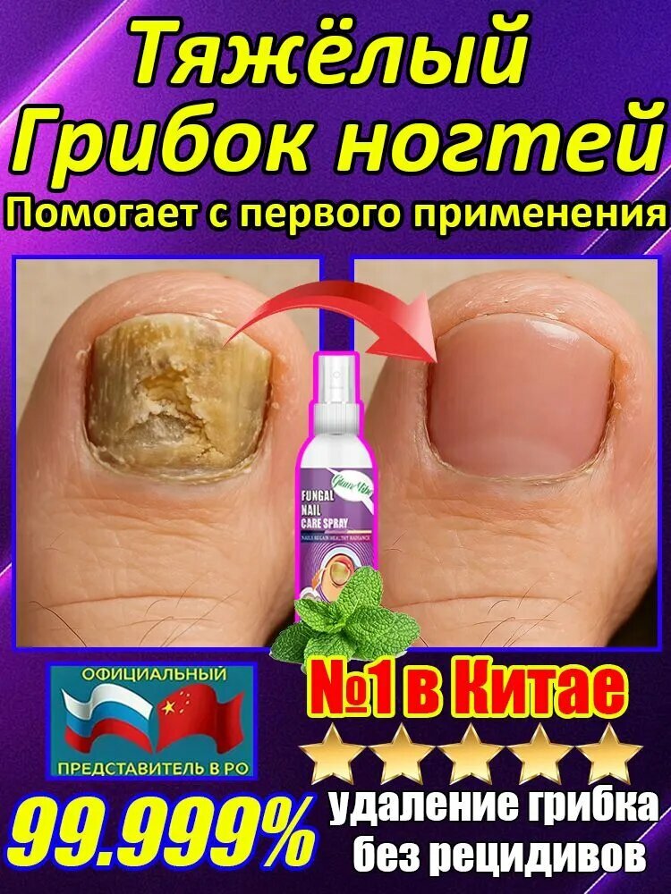 Спрей для лечения грибка ногтей, руках, для лечения грибка и онихолизиса, противогрибковое для роста и укрепление,300мл