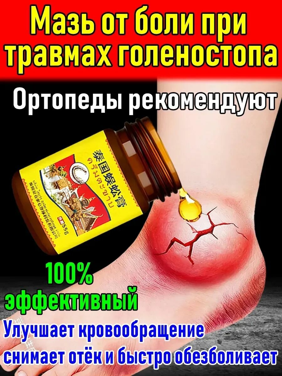 Обезболивающая мазь при растяжении связок голеностопа