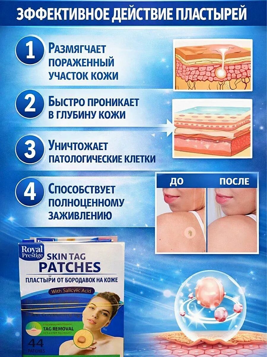 Патчи-точки — фото 1