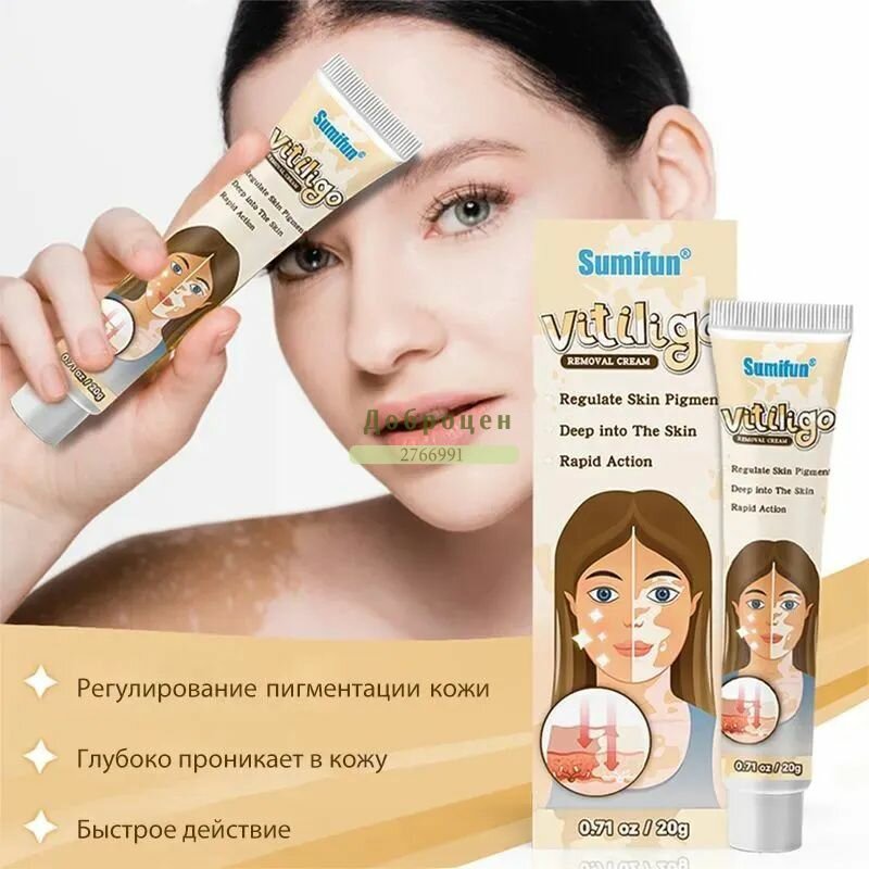 Мазь от витилиго, устраняет ненужную пигментацию, белые пятна, подходит для всего тела, эффективное лечение, отсутствие побочных эффектов