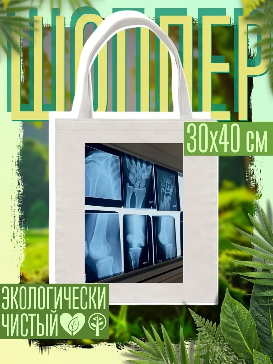 Сумка шоппер Рентгеновские снимки костей