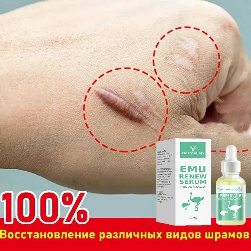 Гель от рубцов, разглаживает гиперплазию и устраняет следы от угревой сыпи и шрамы