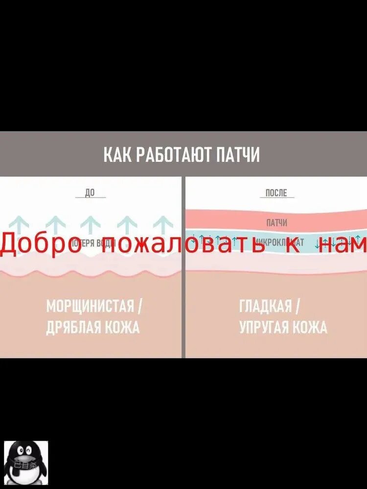 Know EasyxМногоразовые силиконовые патчи для лица стандартная модель базовой серии — фото 1