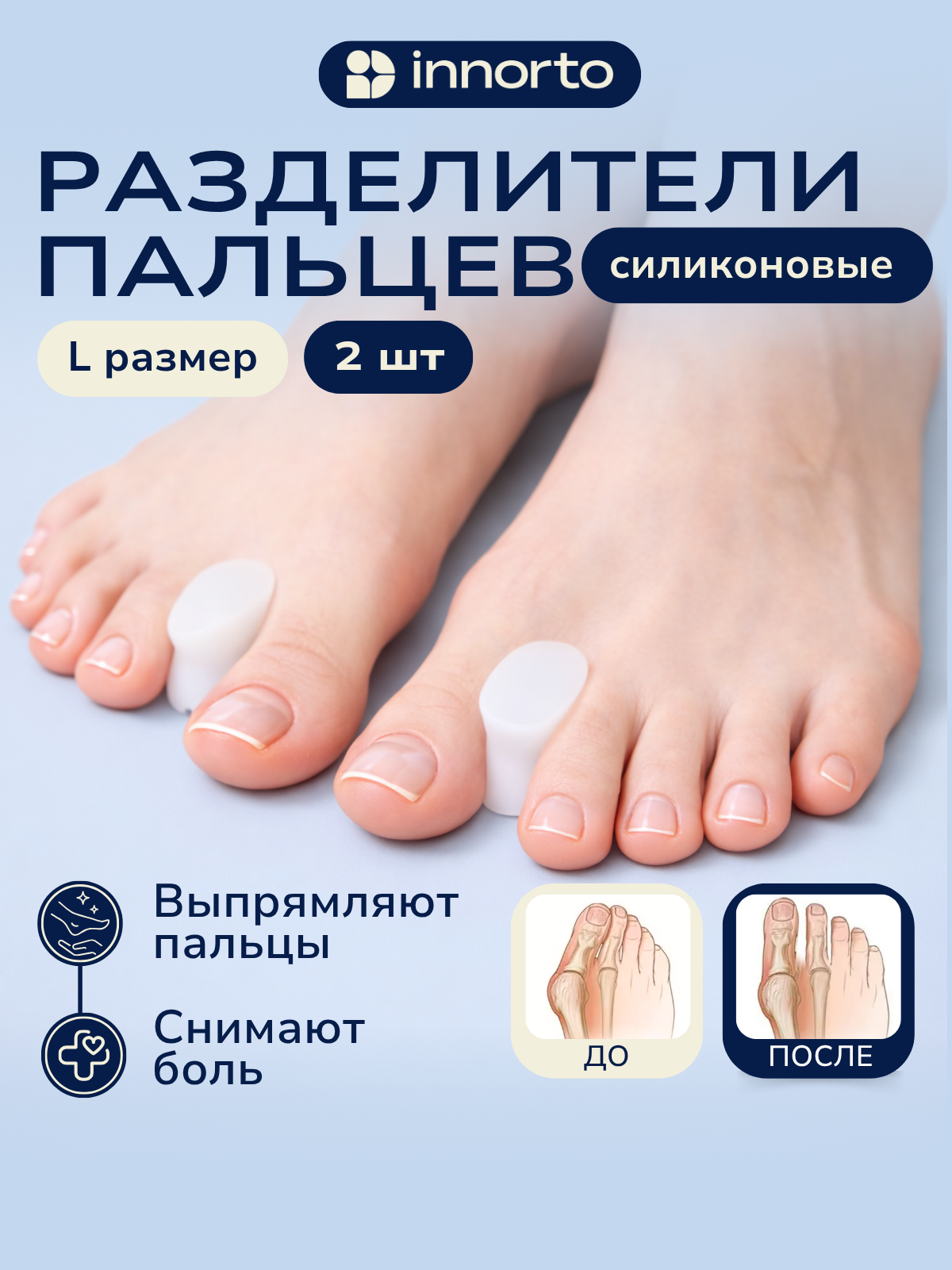 Разделители «INNORTO», артикул 44138, типоразмеры L - 1 пара;