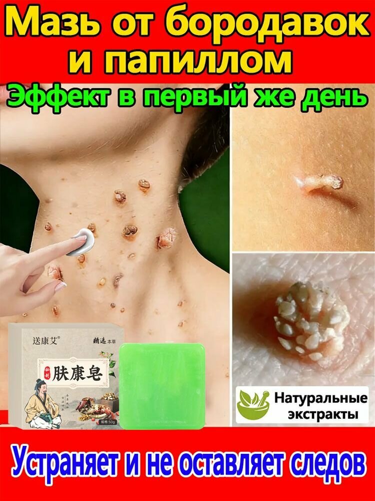 Клареол гель от папиллом / средство от бородавок, чистотел, мазь от сухих мозолей / INNOSKIN Klareol/
