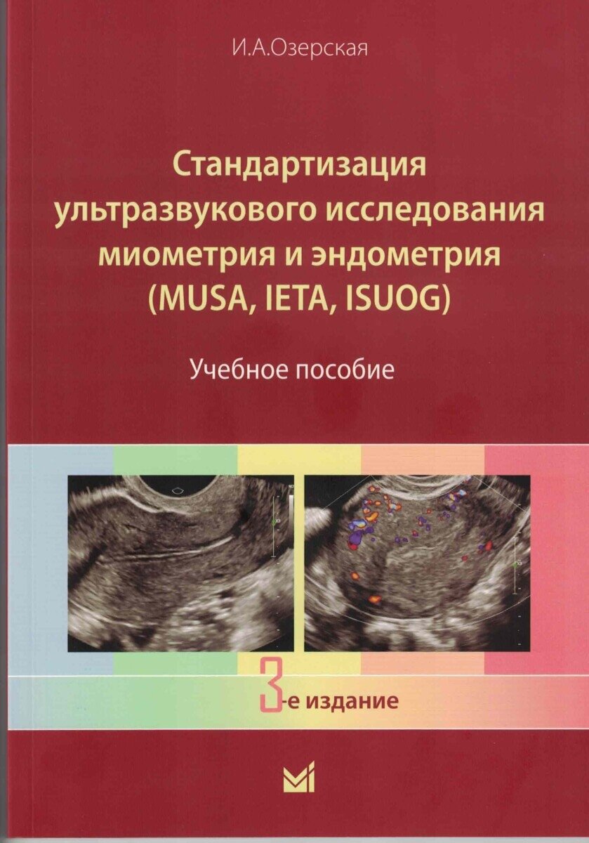 Стандартизация ультразвукового исследования миометрия и эндометрия. MUSA, IETA, ISUOG