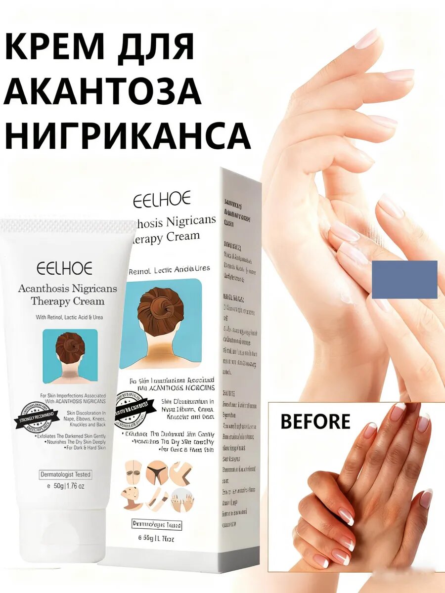Крем для восстановления кожи при аккантозе нигриканс