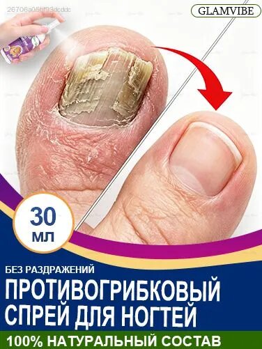 Интенсивный спрей от грибка ногтей 90 мл. Устраняет отслоение и утолщение, восстанавливает структуру, питает ногтевое ложе и стимулирует рост здоровых пластин. Для рук и ног.