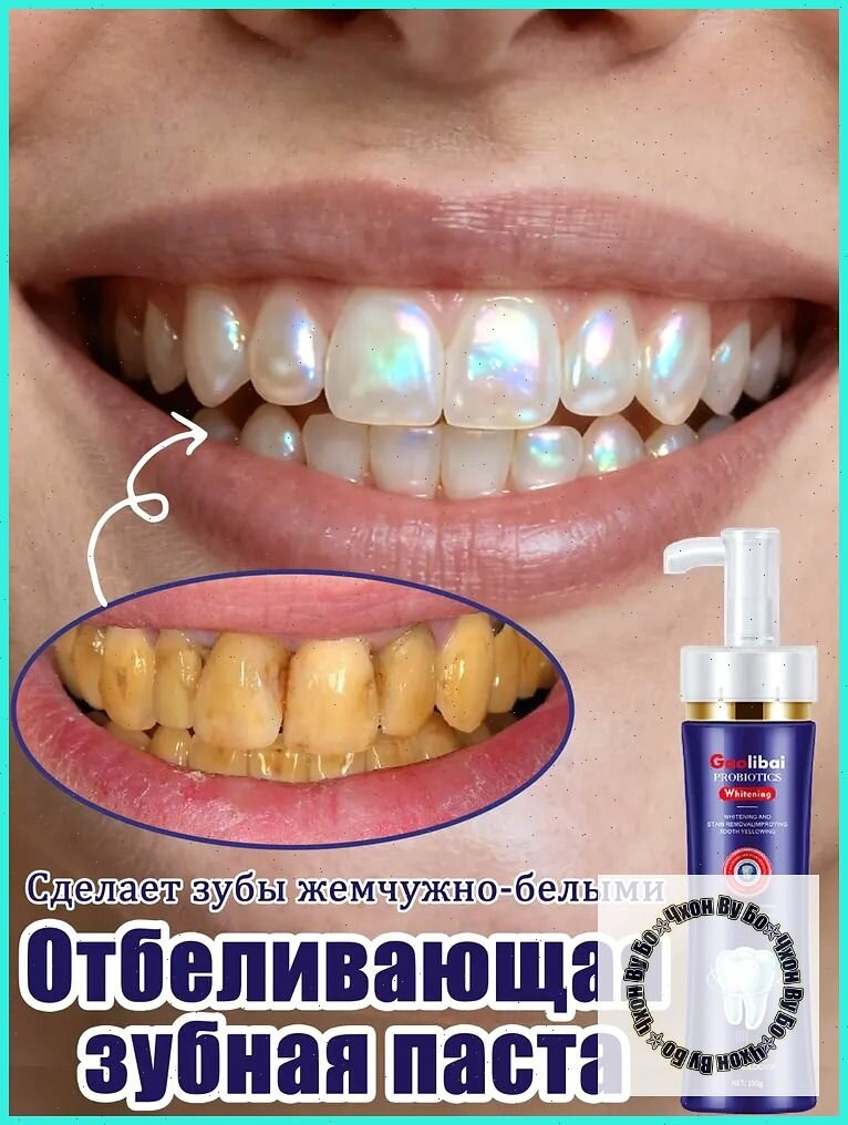 Зубная паста отбеливающая с дозатором, 150 г, очищение зубов, от налета, зубного камня и пятен, для укрепления эмали