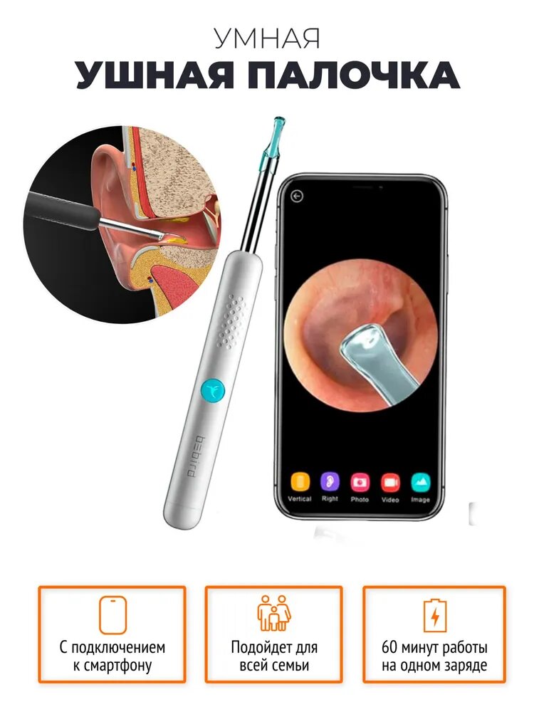 Умная ушная палочка с камерой Bebird Smart Visual Spoon Ear Stick R1, белый