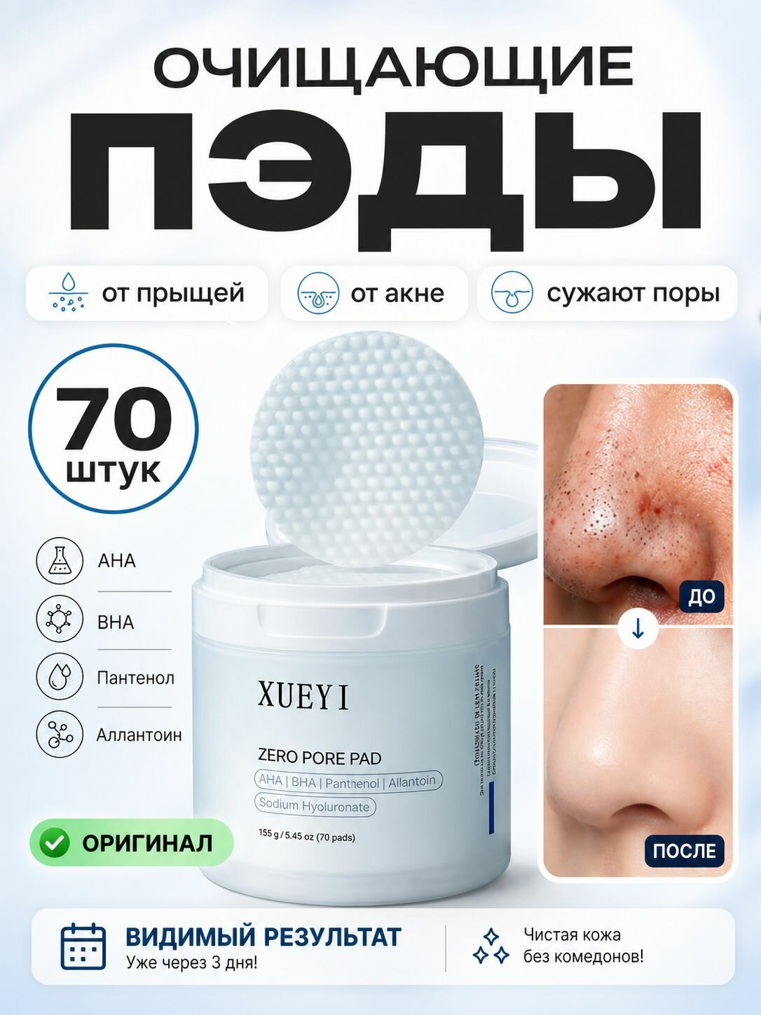 Пэды для отшелушивания кожи от акне, 70 шт