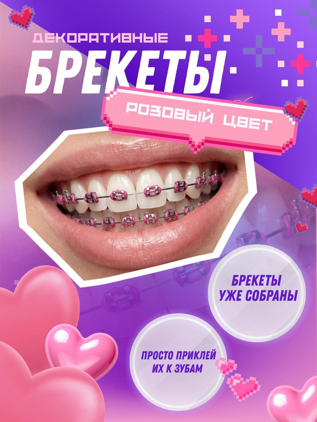 Брекеты для зубов розовые верхние и нижние / Виниры 2 шт.
