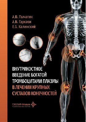 Внутрикостное введение богатой тромбоцитами плазмы в лечении крупных суставов конечностей / Лычагин А. В, Гаркави А. В, Калинский Е. Б.