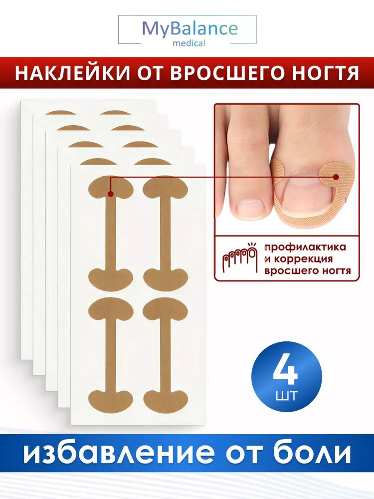 Наклейки от вросшего ногтя, 4 шт.