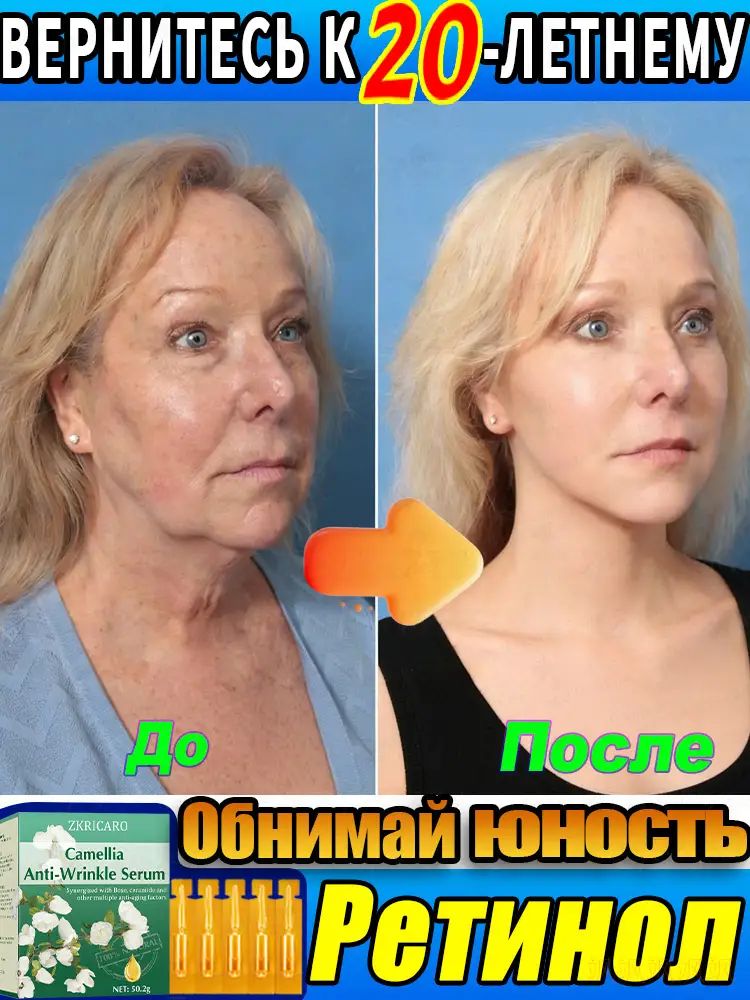 Омолаживающие ампулы эффективно разглаживают морщины и уменьшают отечность. Быстро уменьшают морщины, осветляют пигментные пятна, увлажняют и смягчают кожу, делая ее эластичной. 20 ампул в упаковке.