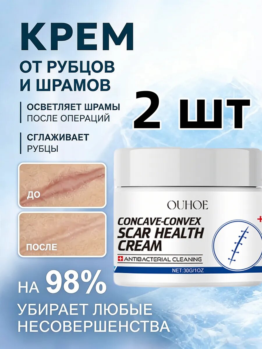Крем от шрамов и рубцов от растяжек, с алоэ вера, для всех типов кожи, 2 шт