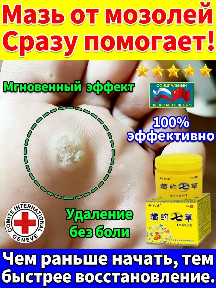 Быстродействующая мазь от мозолей и натоптышей, крем от сухих мозолей, подошвенных бородавок (шипиц), бородавок и натоптышей