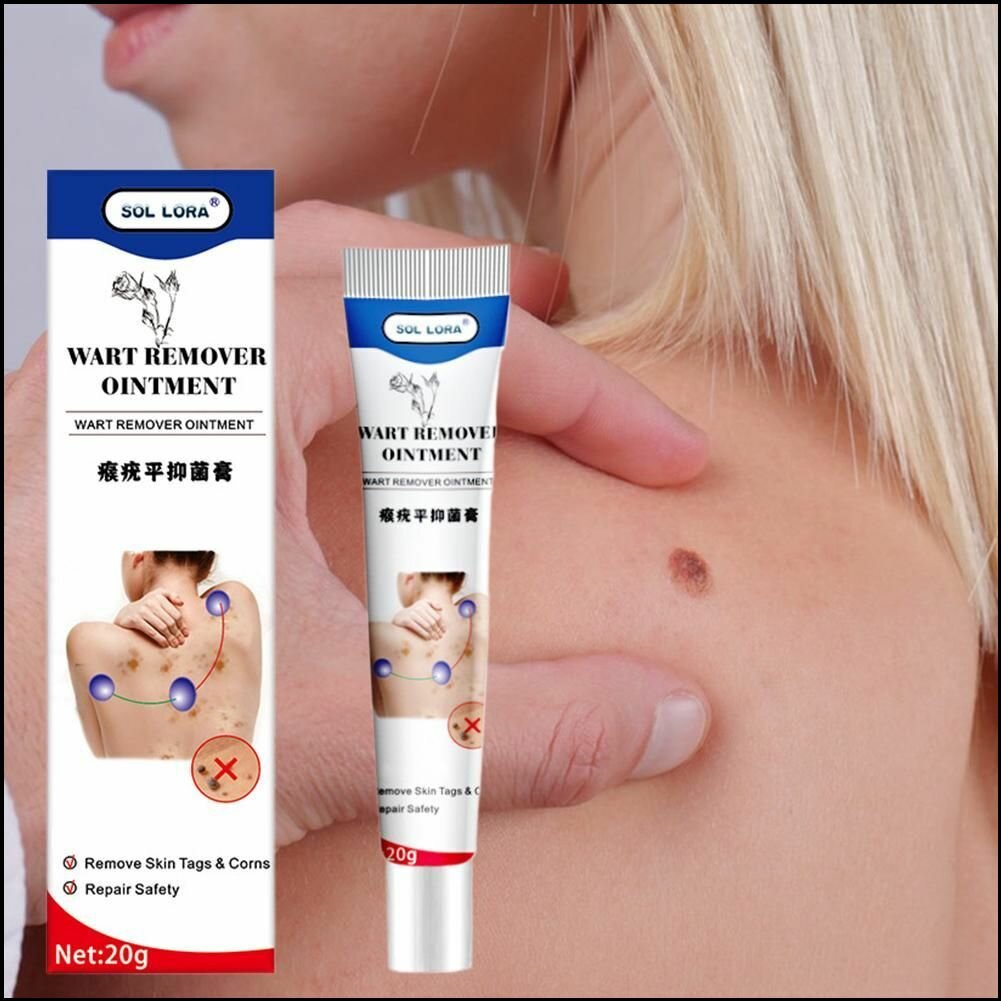 Крем для удаления бородавок, шелковистый пластырь от мозолей 20 г