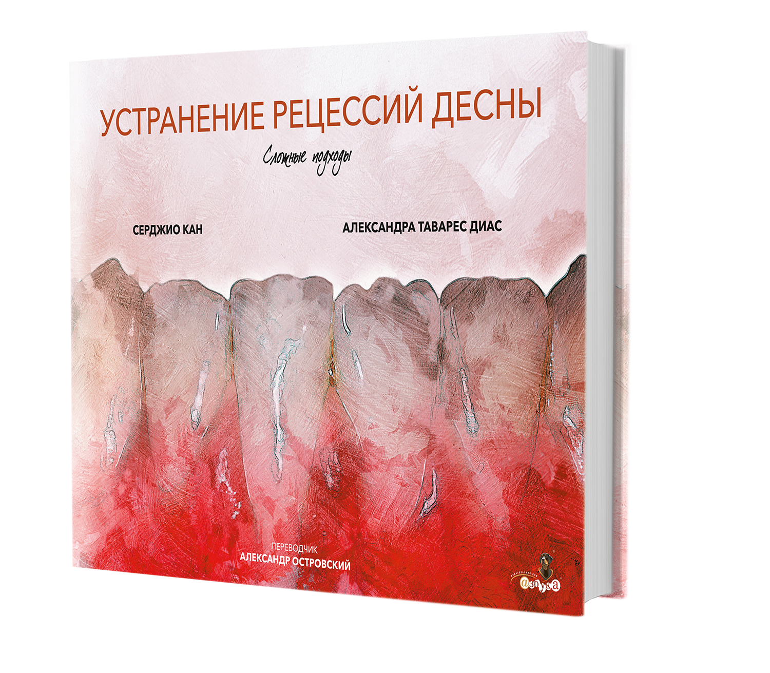 Устранение рецессий десны