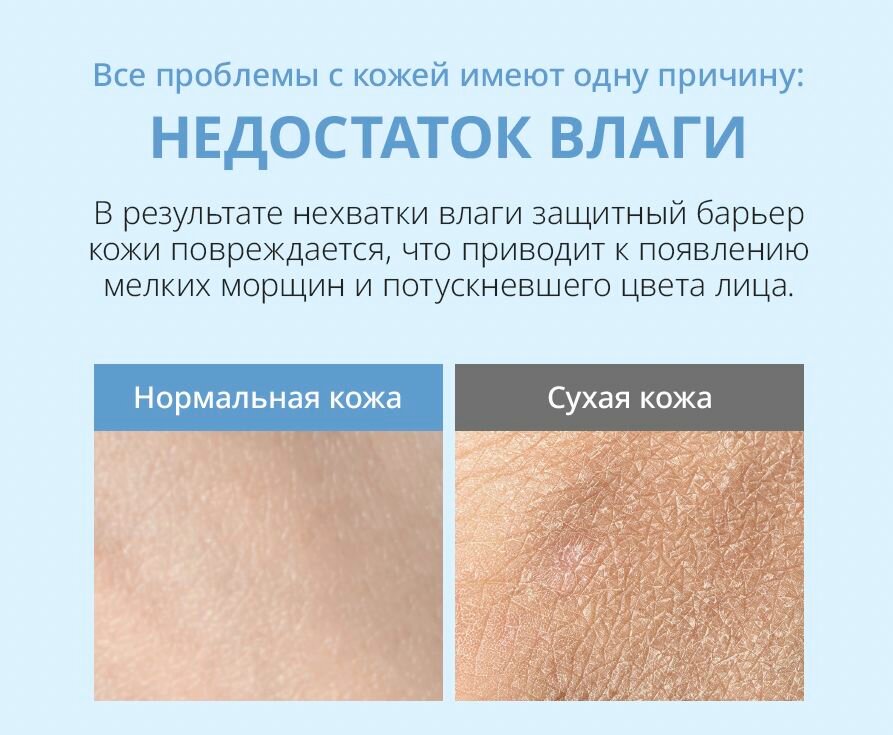 Абсолют Гидра бальзам — фото 1