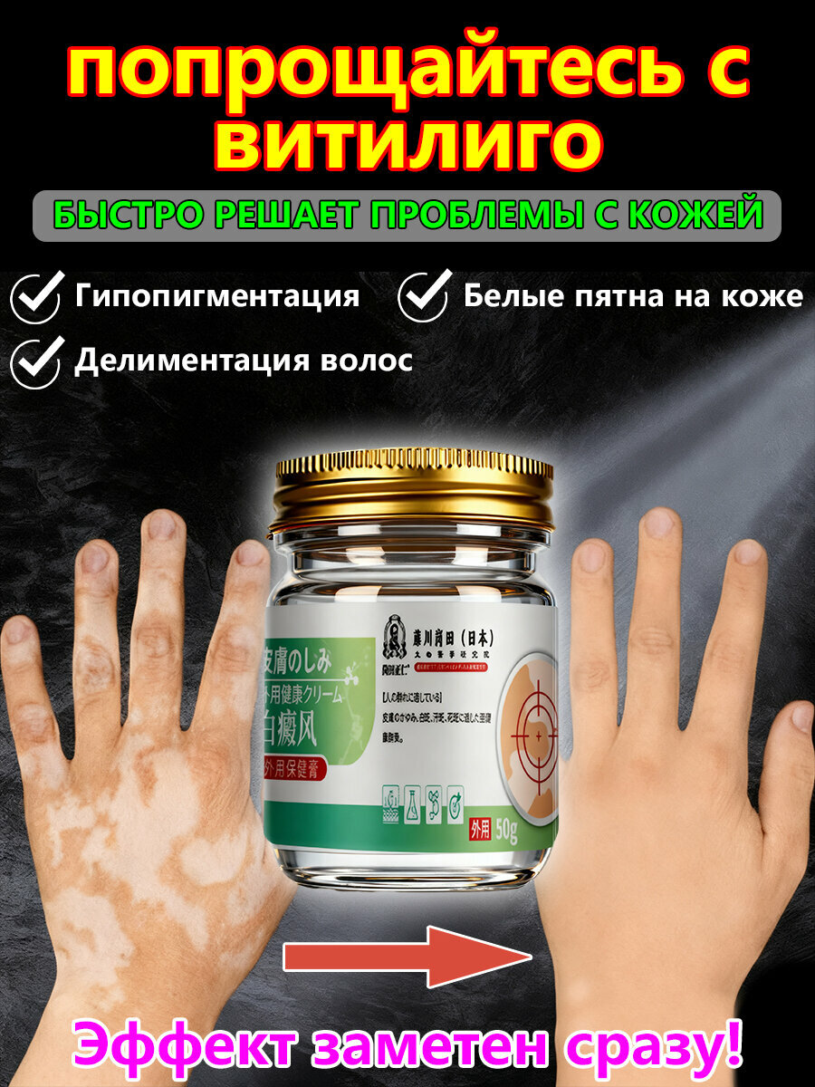Подходит для пациентов с витилиго, лечения белых пятен, устранения пигментации выравнивания тона кожи. устраняет странные взгляды окружающих50 грамм