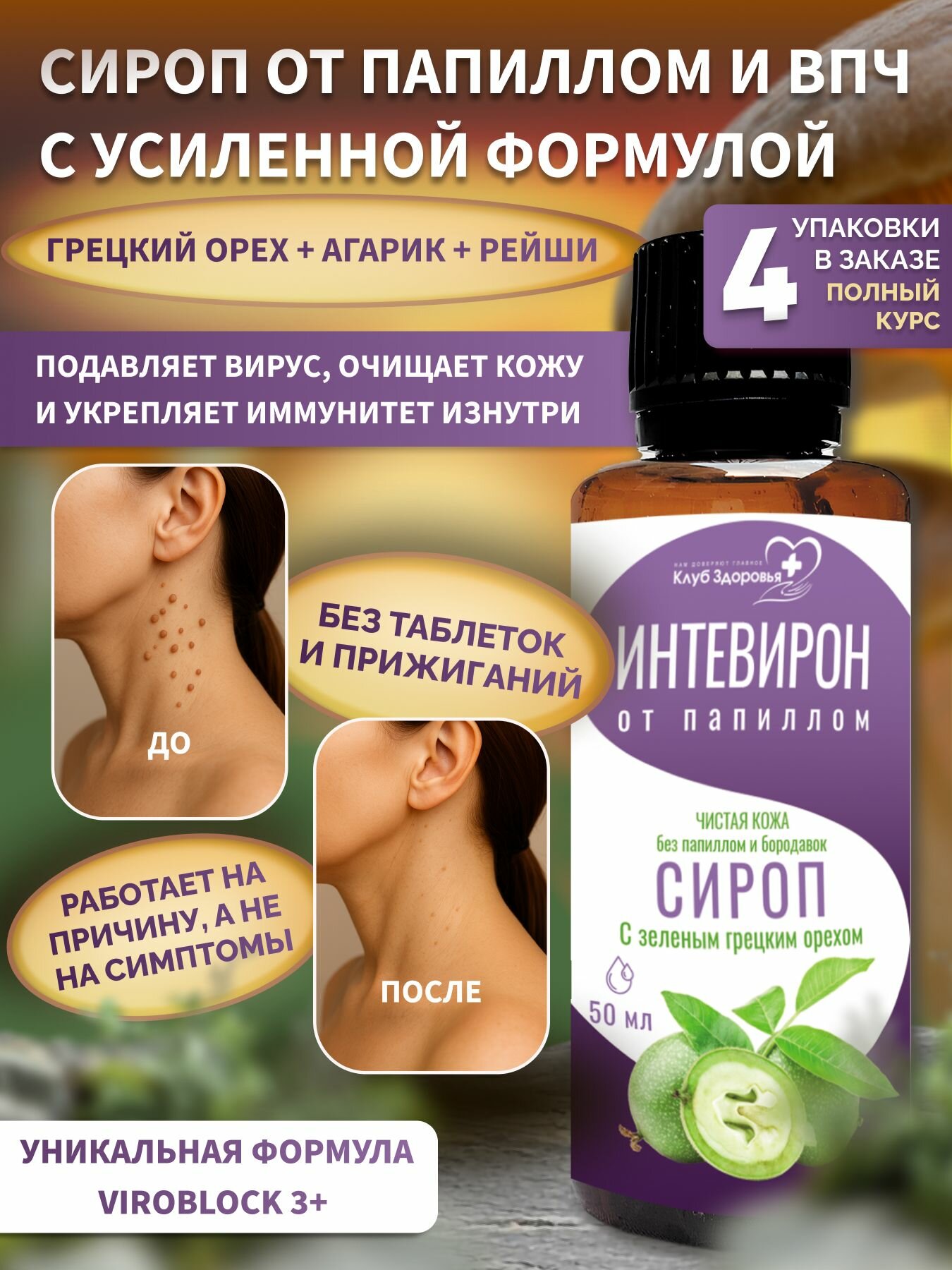 Средство от папиллом; от бородавок; Концентрат пищевой "Интевирон"