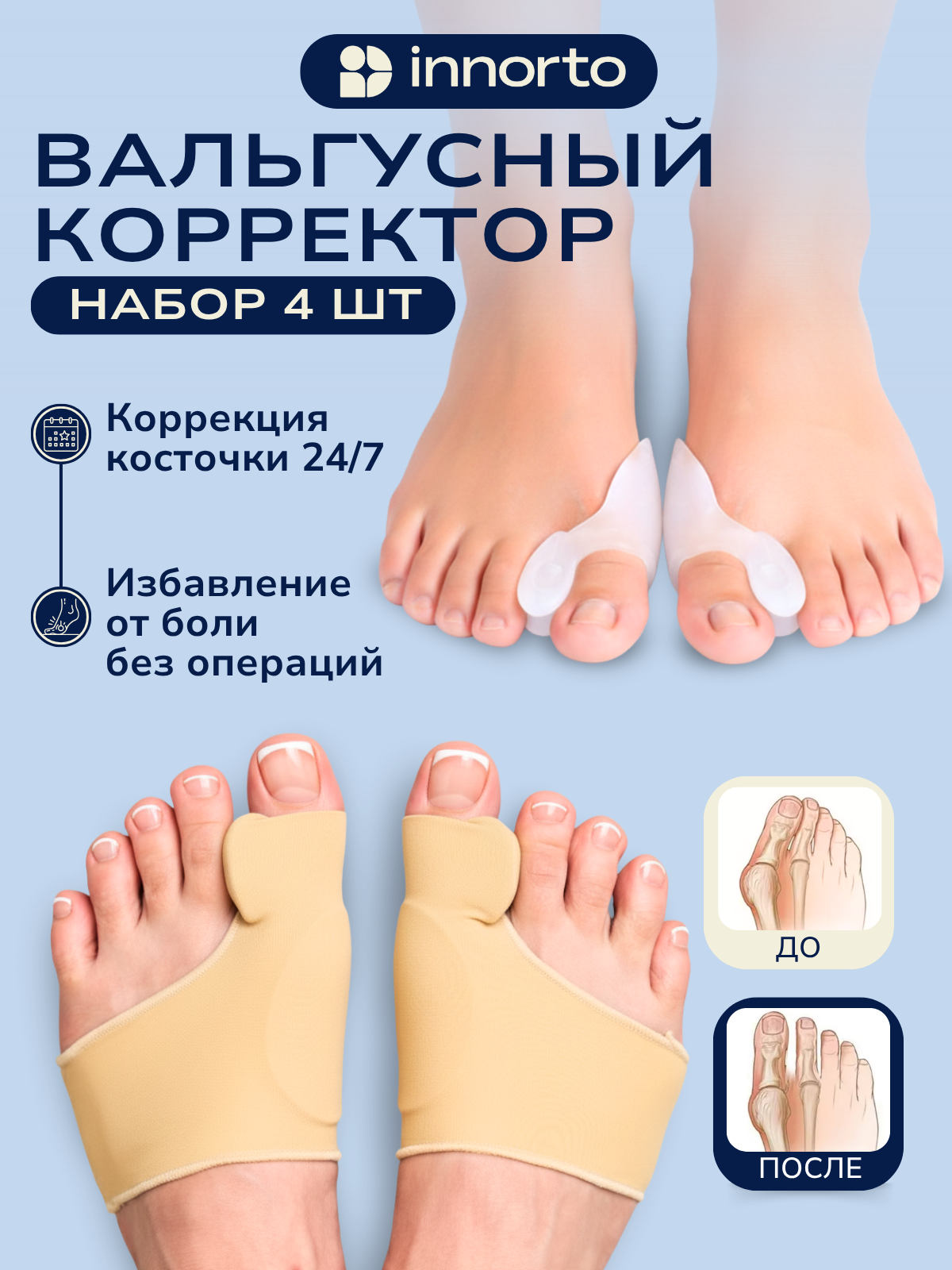 Набор корректоров для косточки большого пальца 4 предмета