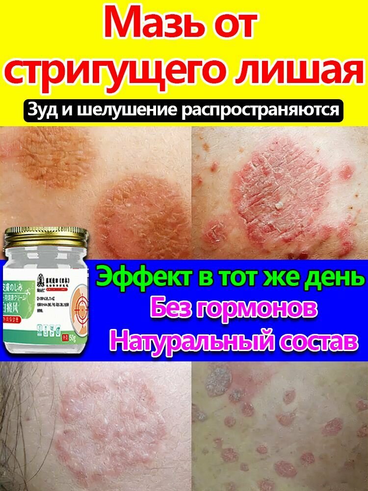 Лечебная мазь от стригущего лишая