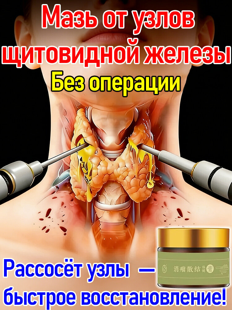 Мазь для рассасывания узлов щитовидной железы