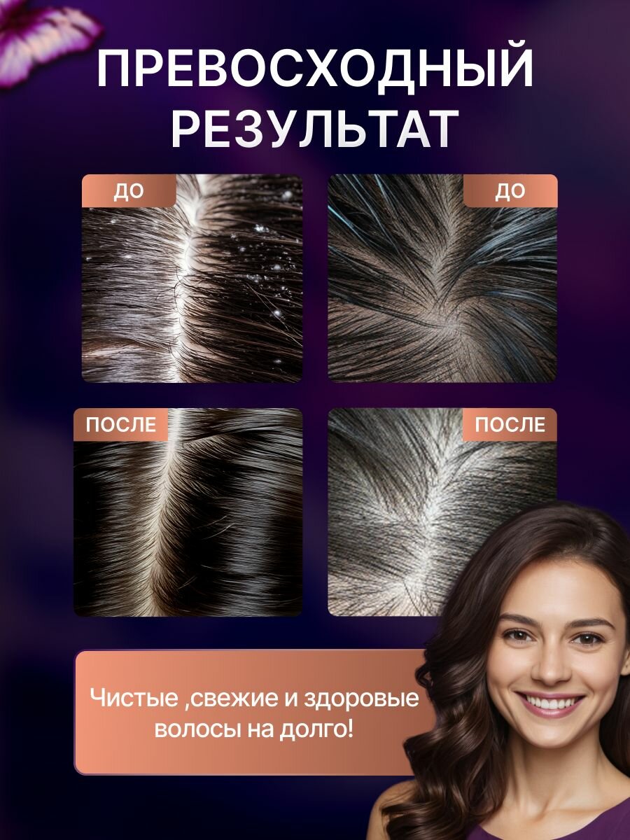 Пилинг Sol Sol Antitox Scalp Primer 150 мл — фото 1