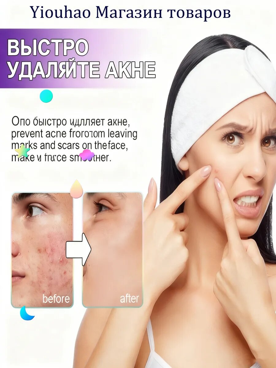 Патч от прыщей для лица — фото 1
