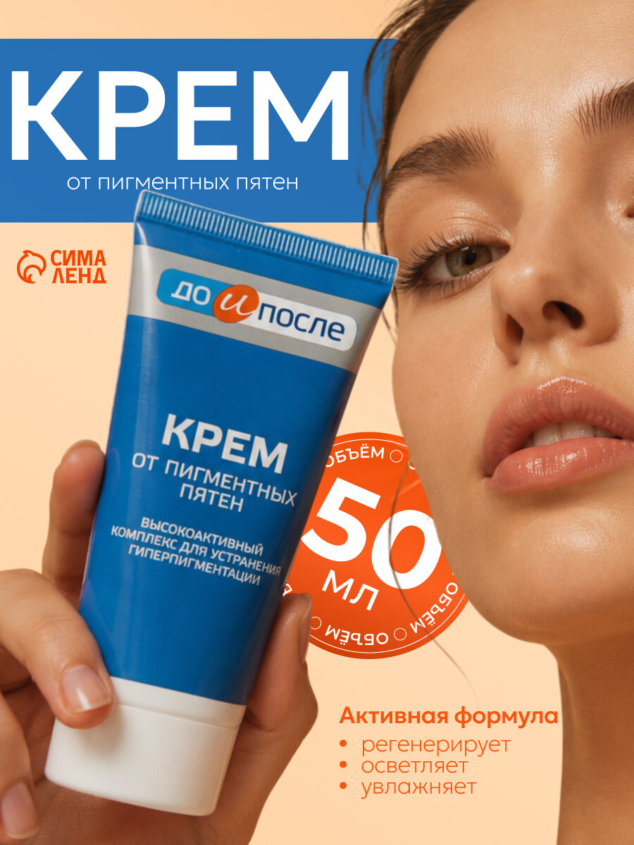 Крем "До и После", от пигментных пятен, для всех типов кожи, 50 мл