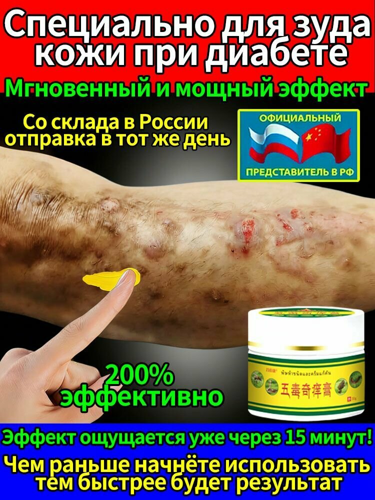 Мазь от кожного зуда при диабете быстрое облегчение