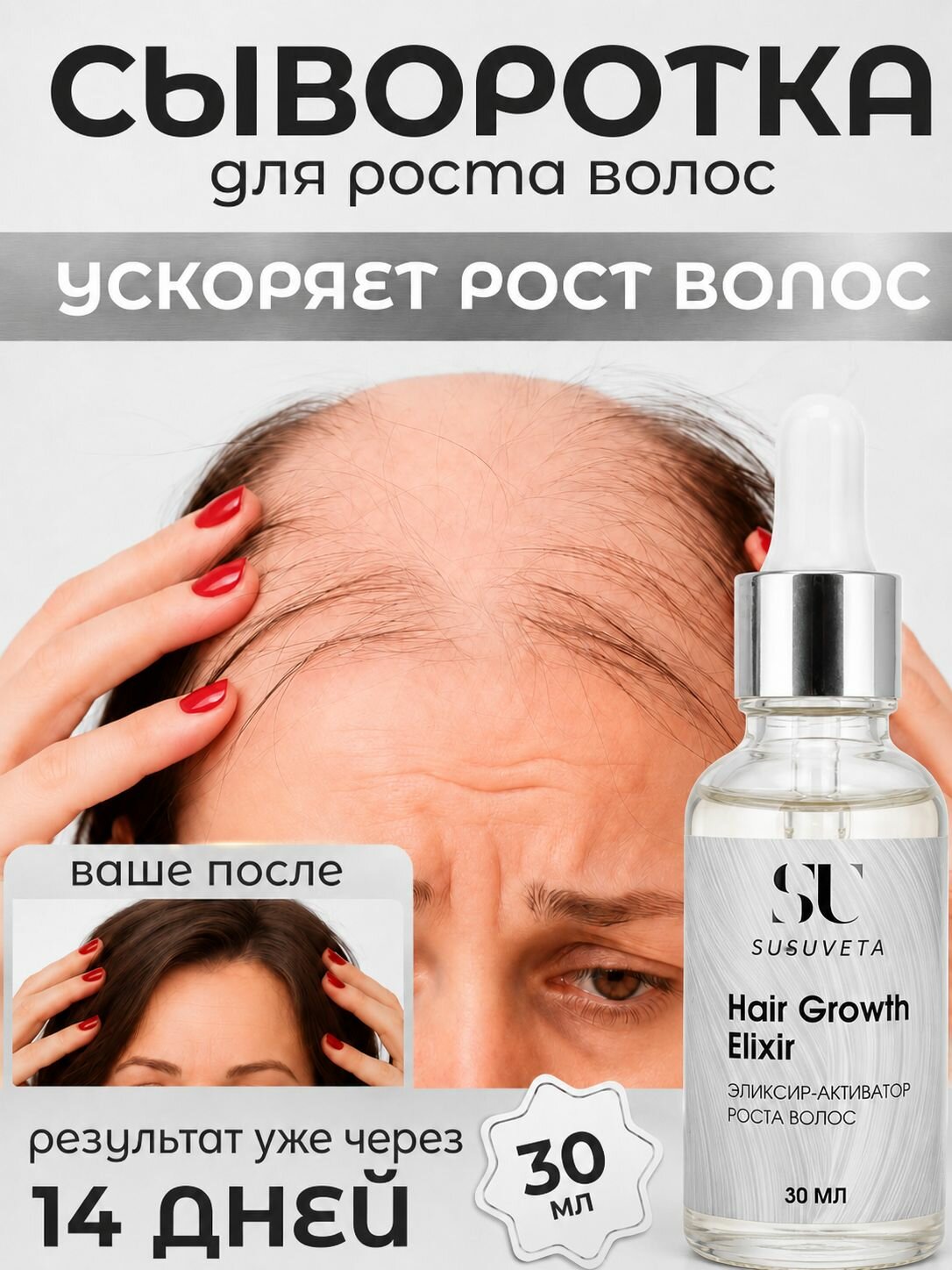 Сыворотка для роста волос и от выпадения, SUSUVETA, предотвращает выпадение и облысение, увеличивает густоту волос, 30 мл