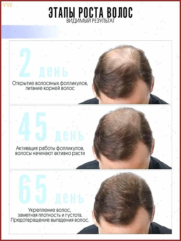 Шампунь для волос, 300 мл