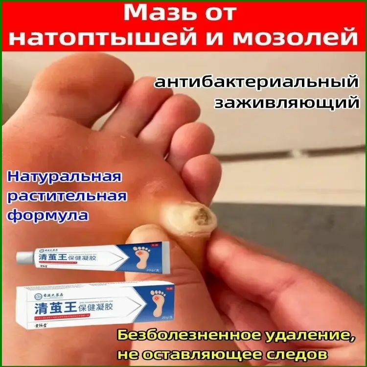 Качественная мазь применяется от стержневых мозолей, натоптышей, шипиц, пяточных шпор и бородавок