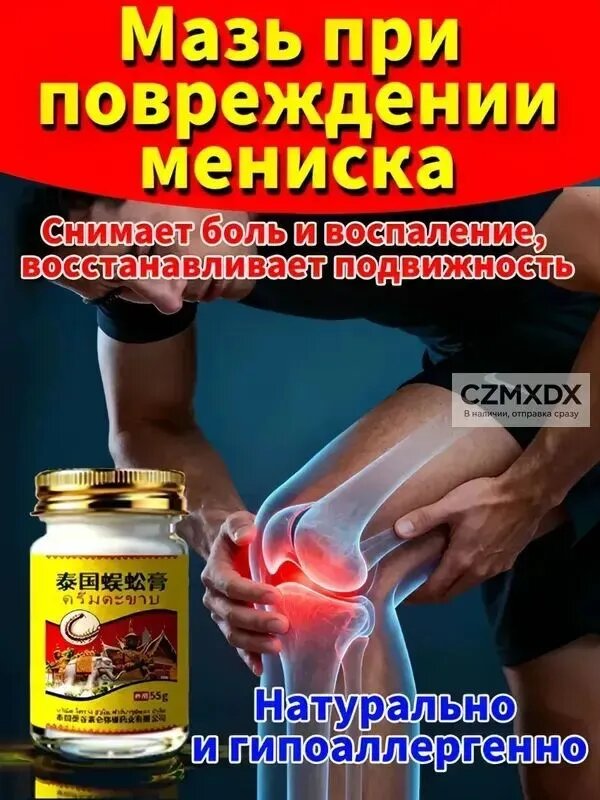 Мазь при повреждении мениска коленного сустава