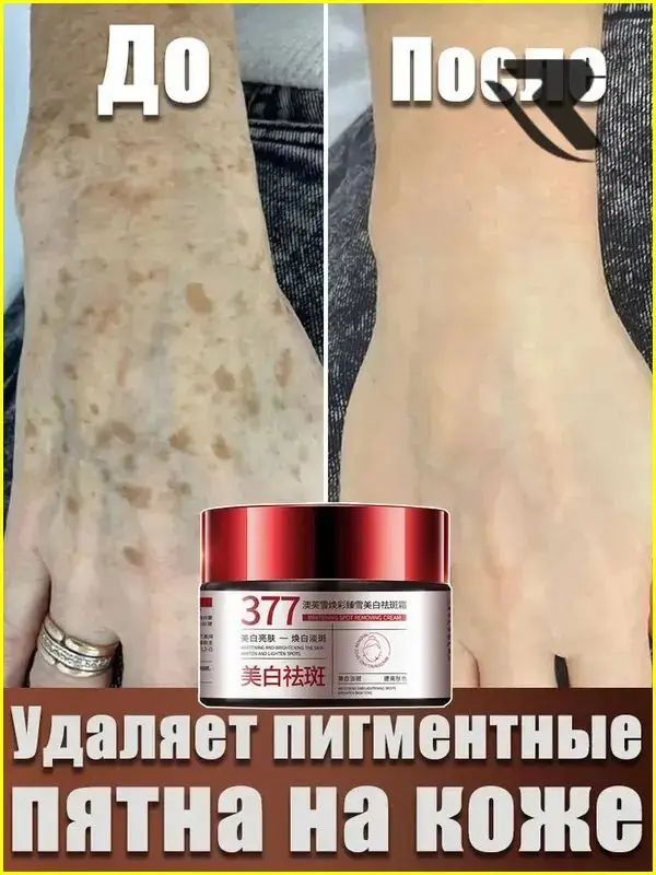 Крем от пигментации для лица, удаляет пигментные пятна, против пигментации, осветляет, для мужчин и женщин, 30 г