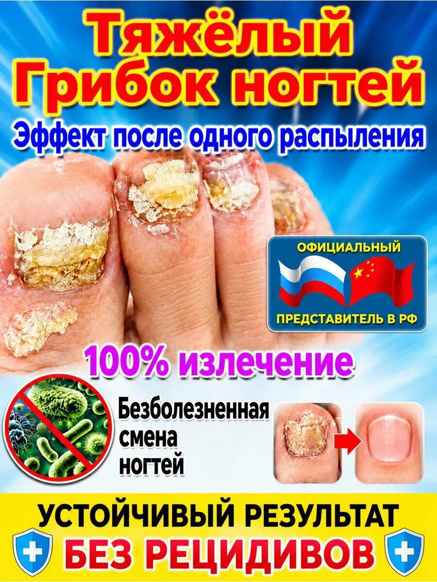 Ноготок мазь от грибка россия