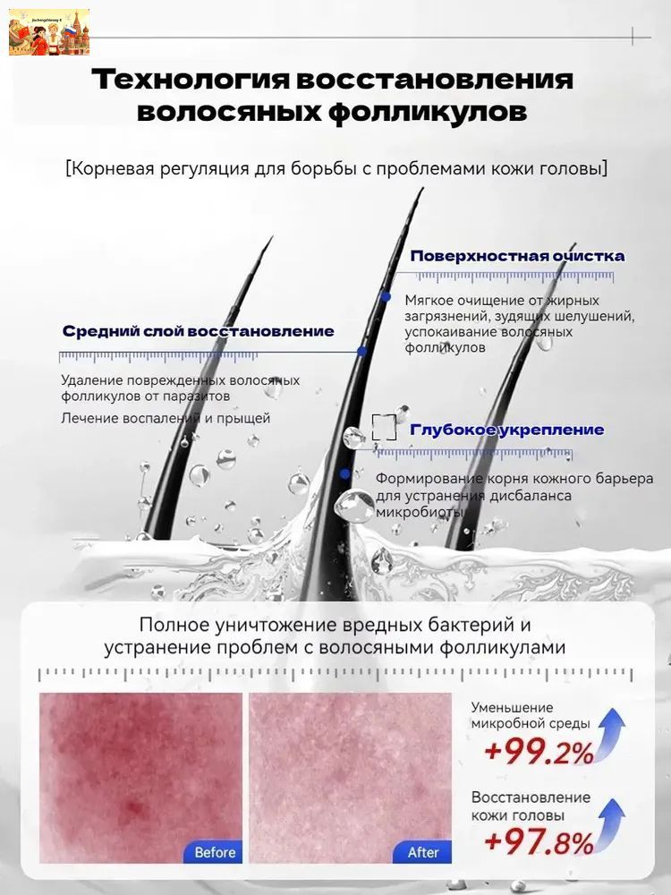 Спрей от прыщей на коже головы лечебный, средство против угрей, зуда и фолликулита, сыворотка для лечения себорейного