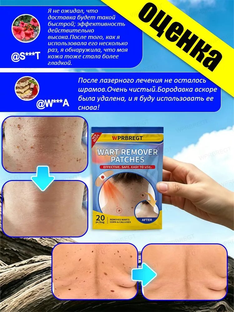 Пластырь от папилломы/бородавок Chelidonium Chinense, подходит для тела, рук и шеи; пластырь от бородавок Chelidonium Chinense, пластырь от сухих мозолей, средство для удаления бородавок / 20 штук