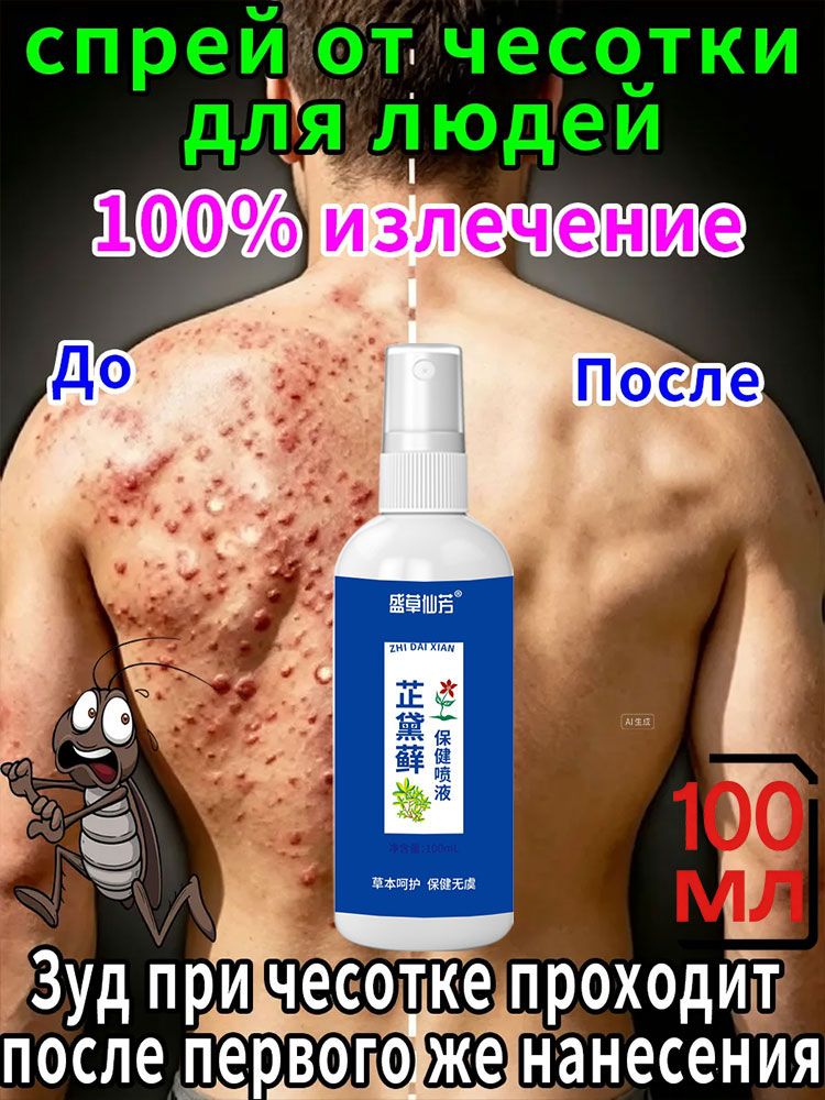 Китайская формула спрей от чесотки, псориаза, экземы и дерматита! Натуральное решение кожных проблем100 мл