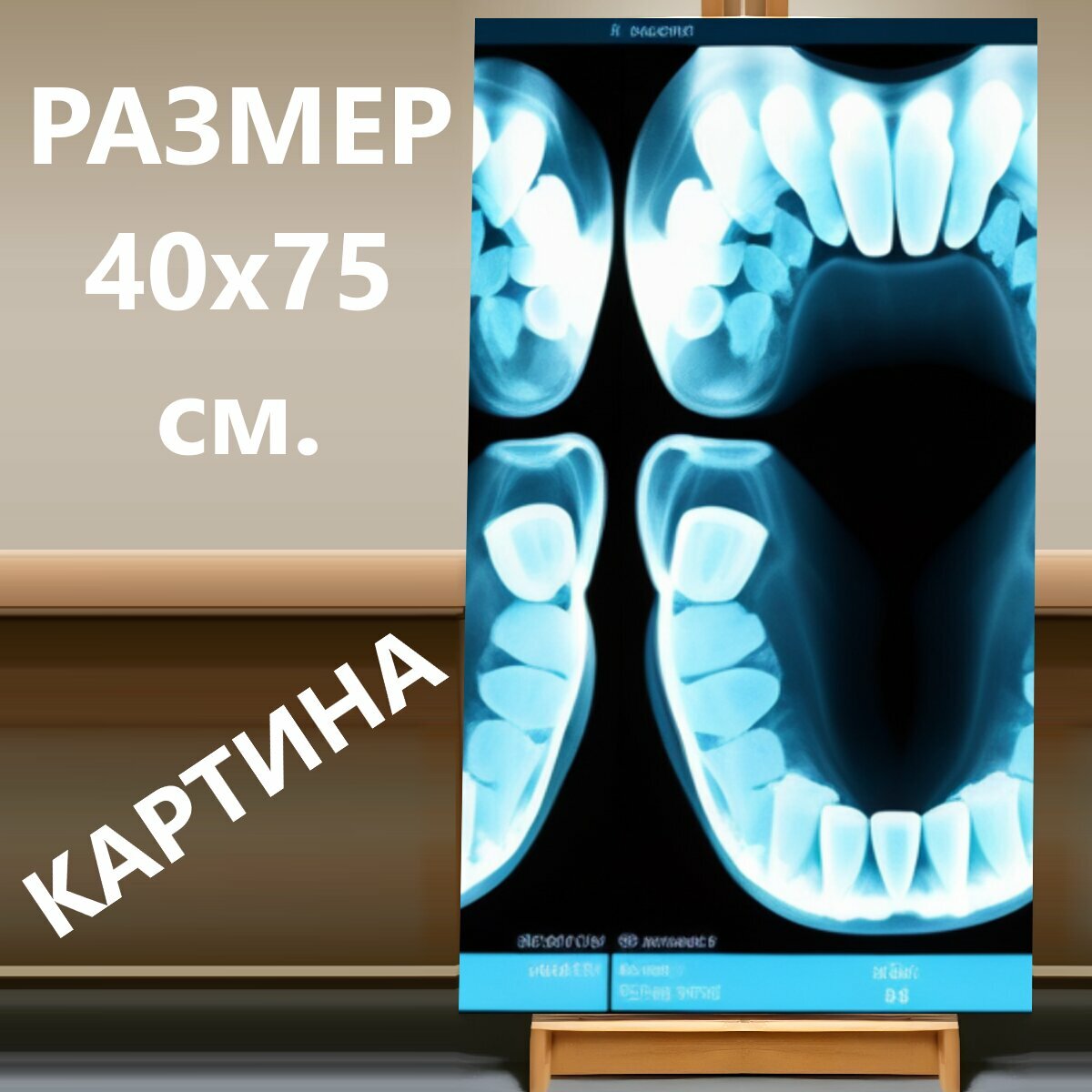 Картина на холсте "Как зубы выглядят на рентгене" на подрамнике 75х40 см. для интерьера